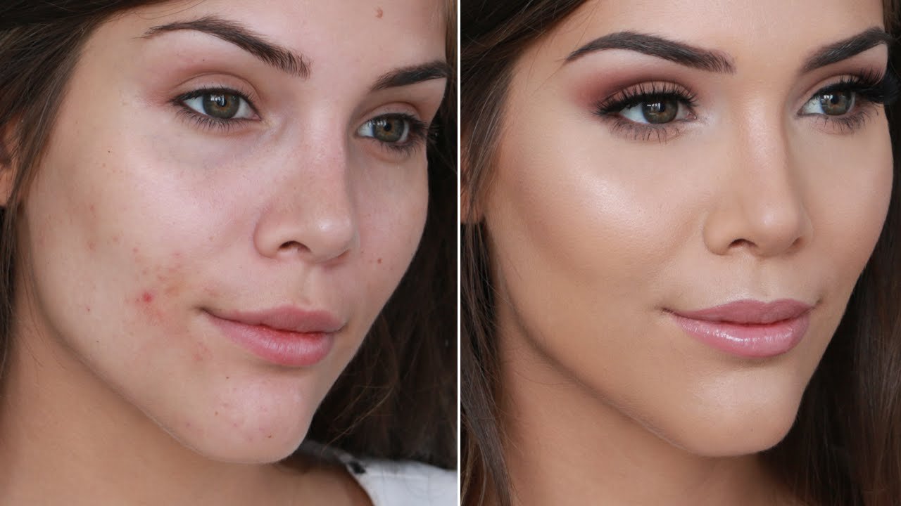 How Do You Cover a Pimple With Concealer - The Product Guide